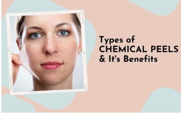 Chemical Peel Before and After Results | Skin Transformation