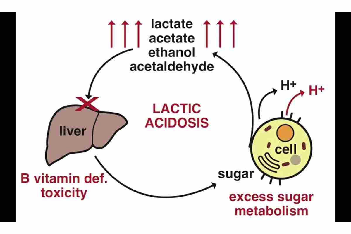 Lactic Acidosis Write For Us - Guest Post, and Contribution
